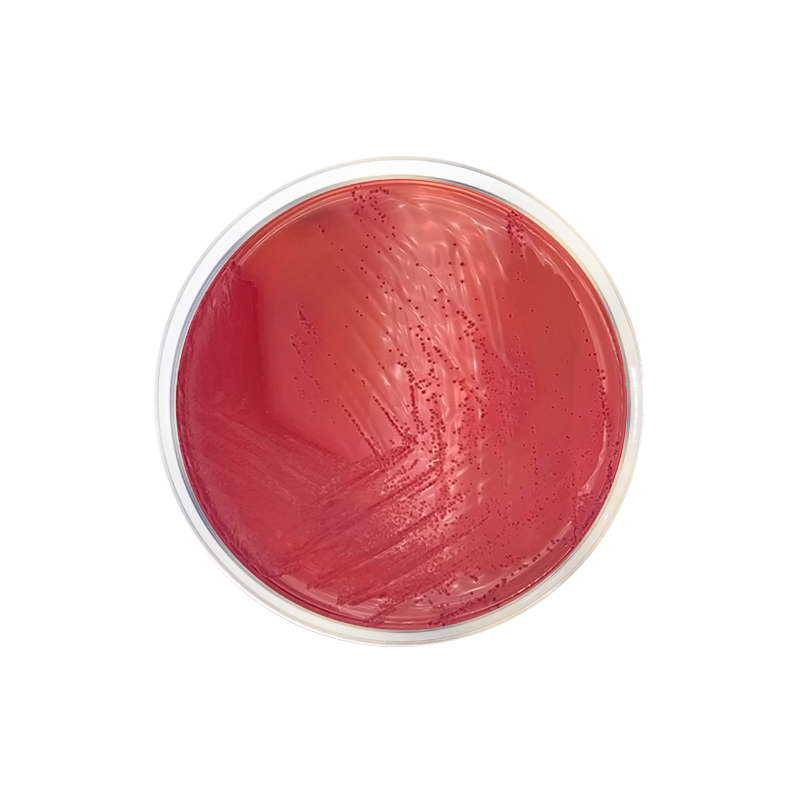 Xld Agar Yersinia Entercolitica XLD Agar (xylose, Lysine Deoxycholate