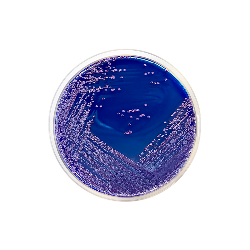 Brilliant Green Agar Results