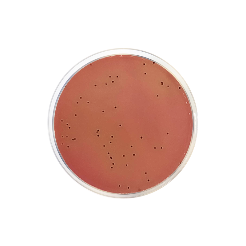Salmonella Ss Agar