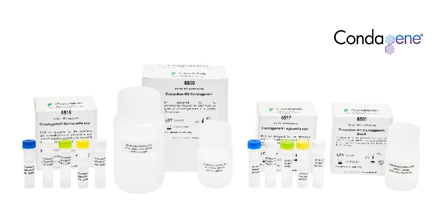 qPCR vs microbiologia tradicional ¿Quién gana?