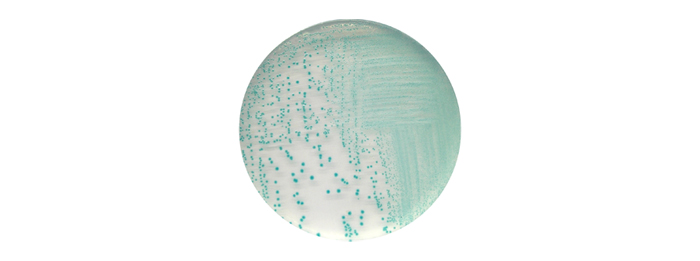 Acogiendo la innovación: medios cromogénicos en métodos de referencia