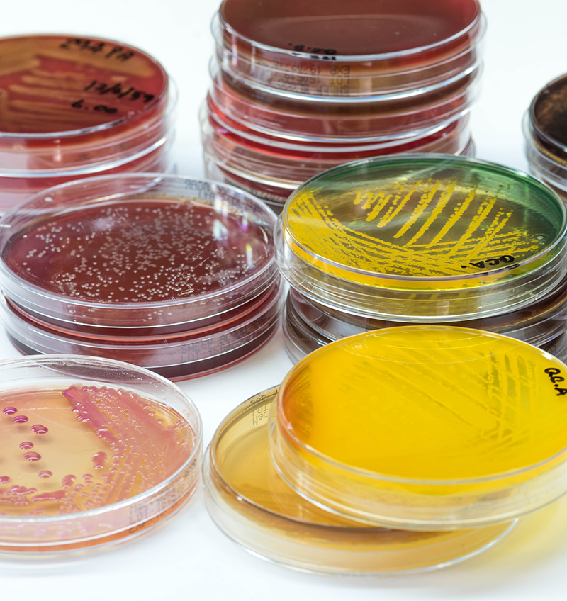 Rapid microbiology webinar